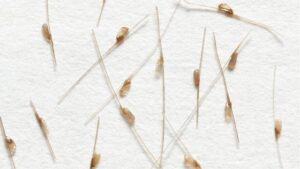 Come eliminare i pidocchi dai capelli | 1000Farmacie